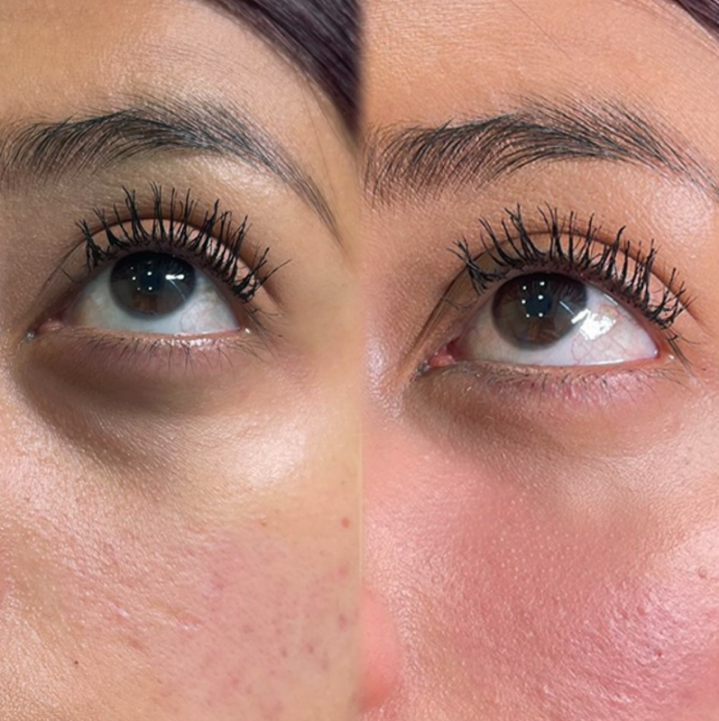 Be Aesthetic RD - Clínica Estética de Lujo